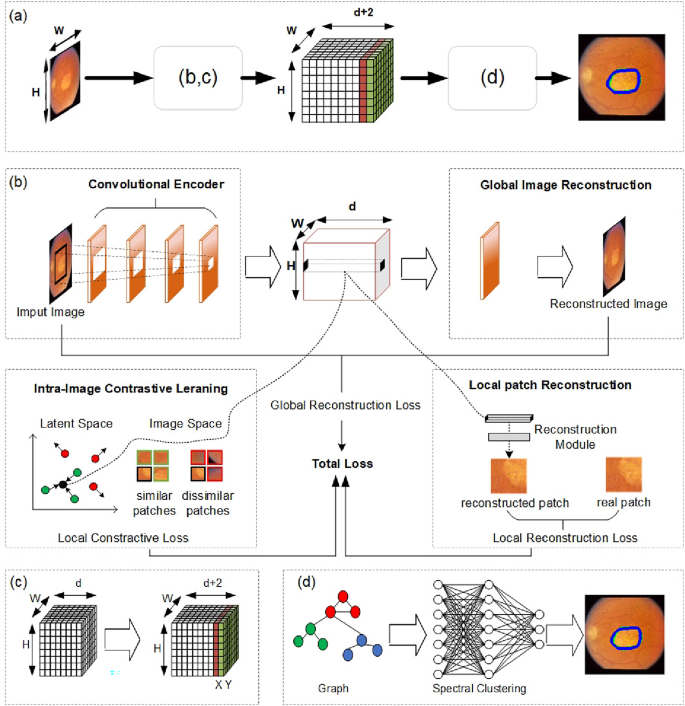 DRCL: rethinking jigsaw puzzles for unsupervised medical image segmentation | The Visual Computer