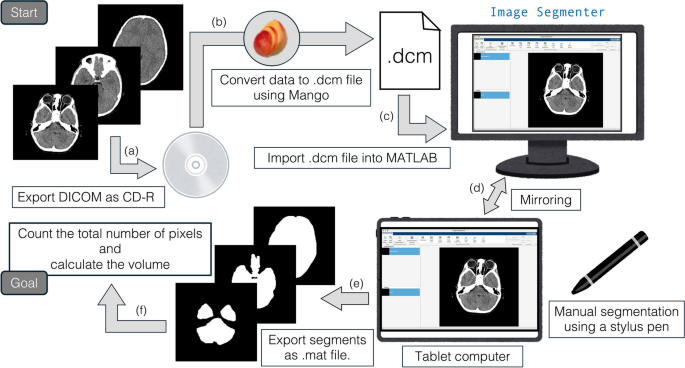 Methodology for pediatric head computed tomography image segmentation ...