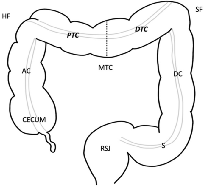 Surgical maneuvers for long-segment Hirschsprung pull-through in unique ...