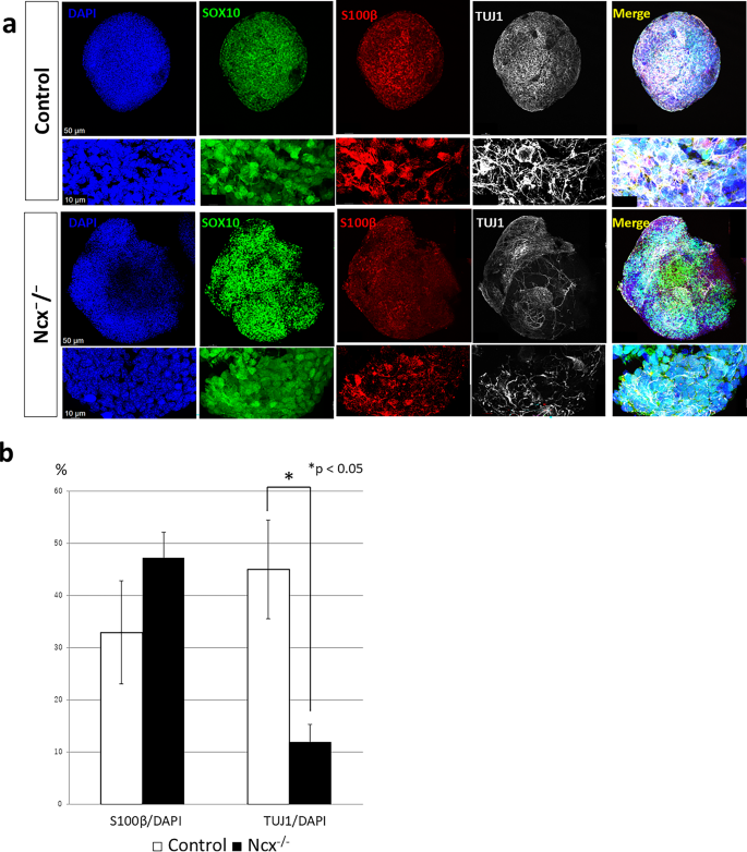 Altered enteric neurodevelopment in the Ncx knockout mouse model of ...