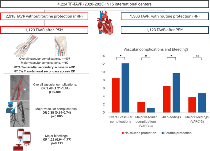 Secondary access and routine protection wire for transfemoral ...