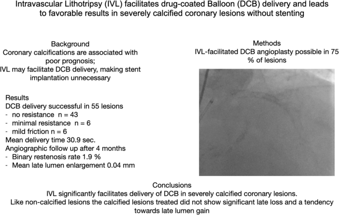 Intravascular lithotripsy (IVL) facilitates drug-coated balloon (DCB ...