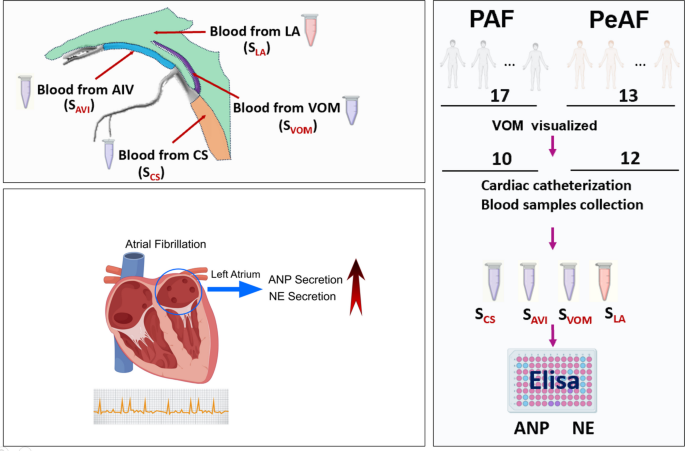 A novel technique for vein of Marshall blood sampling and its ...