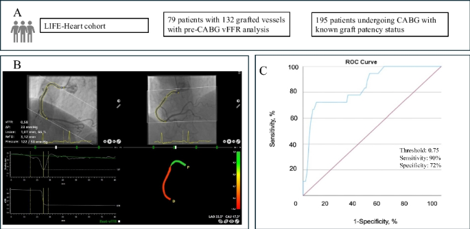 Angiography-derived fractional flow reserve in predicting graft ...