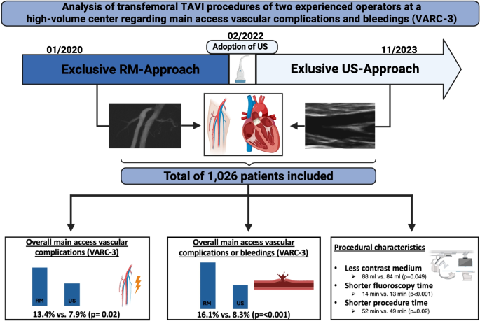 Ultrasound versus angiographic guided access in transfemoral TAVI ...