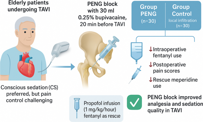 Pericapsular nerve group block reduces fentanyl use in transcatheter ...