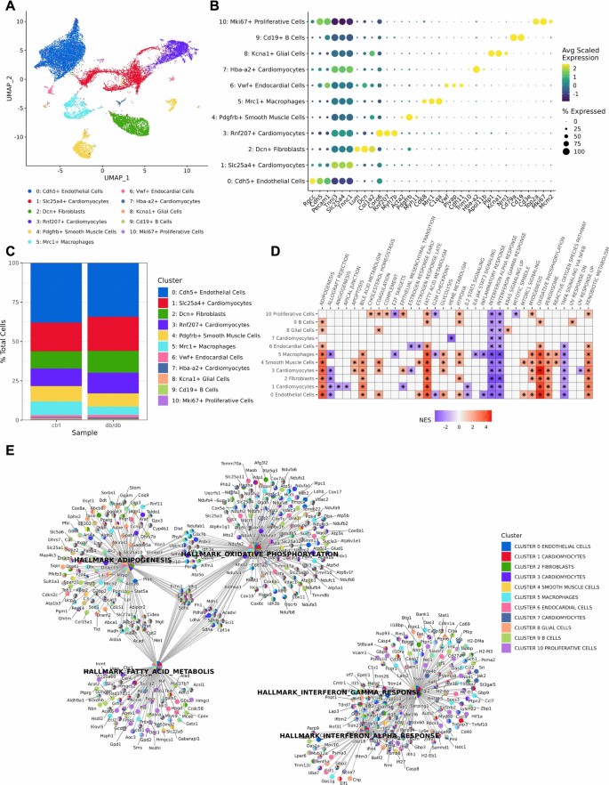 Single cell and spatial transcriptomic profiling of the type 2 diabetic ...