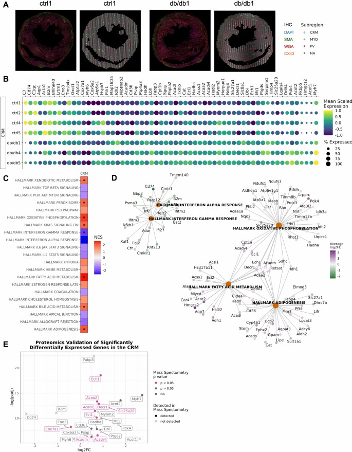 Single cell and spatial transcriptomic profiling of the type 2 diabetic ...
