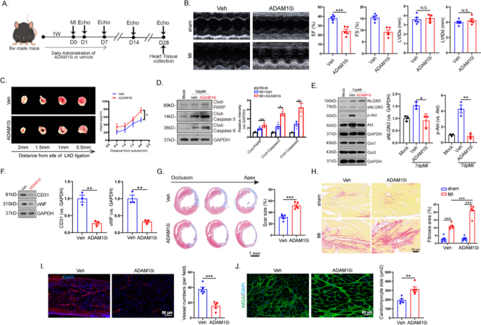 NLGN3 contributes to angiogenesis in myocardial infarction via ...