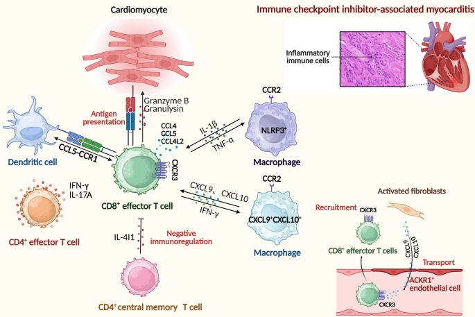 Pathological mechanisms and treatment strategies for immune checkpoint ...
