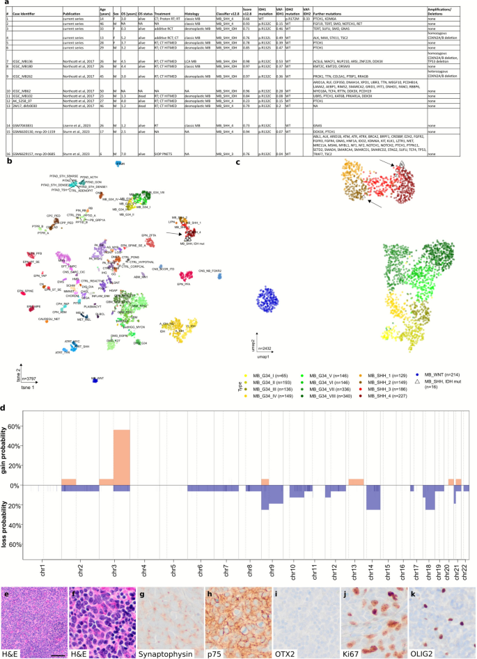 IDH mutations are rare events in SHH medulloblastoma | Acta ...