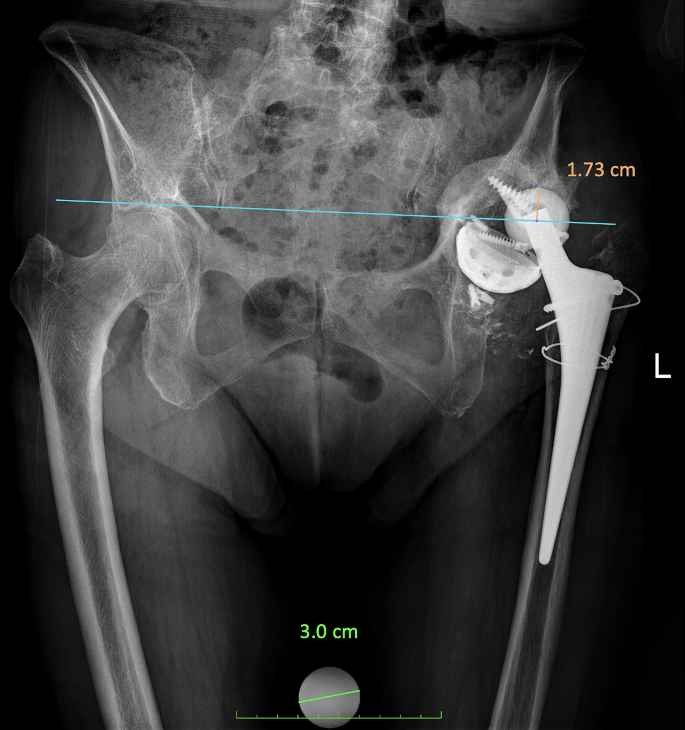 A new classification to characterize and predict treatment of ...