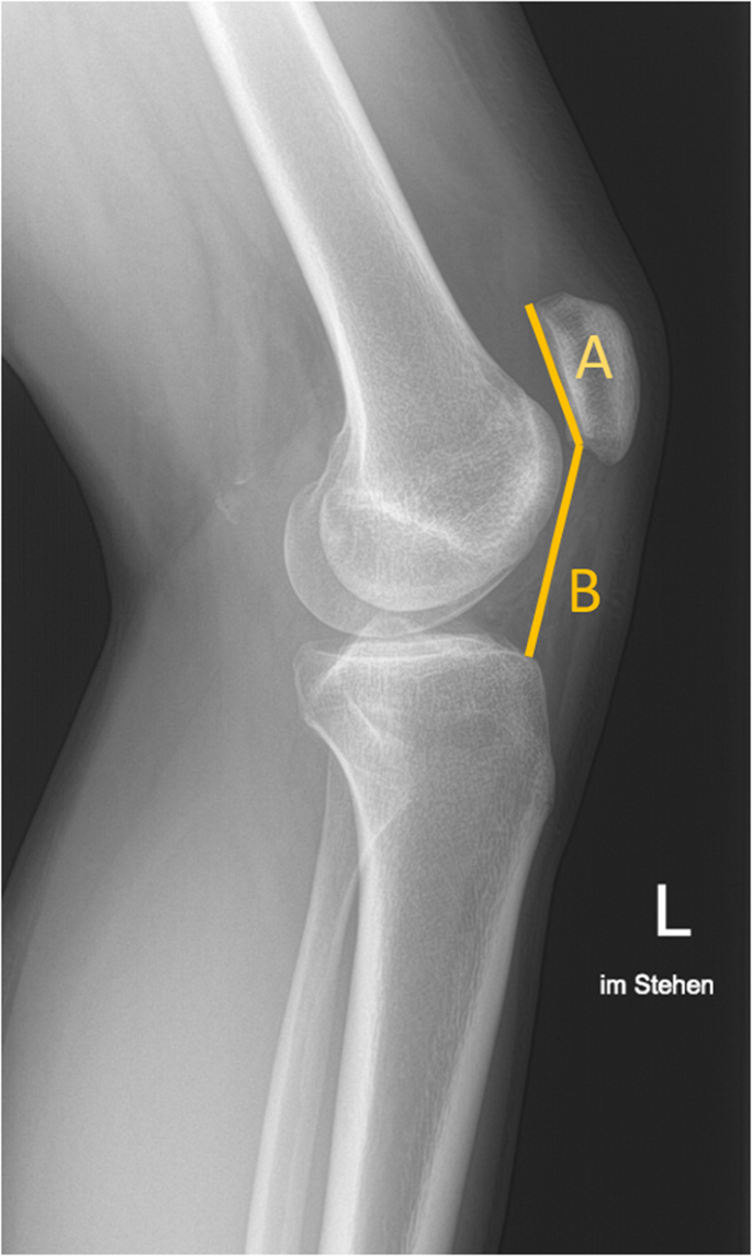 An evaluation of a novel method for the MRI-based assessment of Caton ...