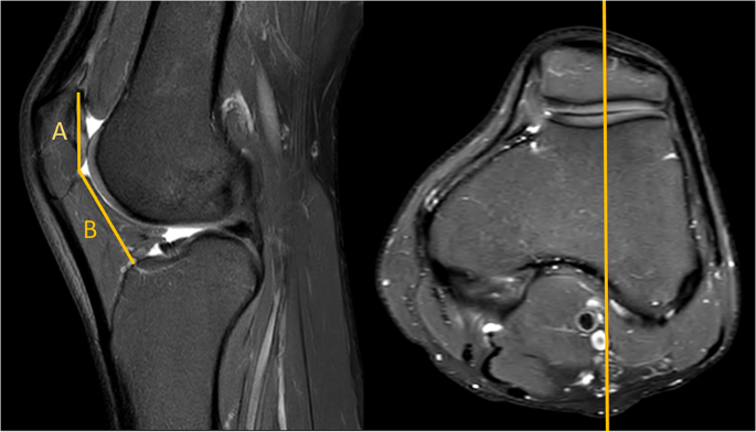 An evaluation of a novel method for the MRI-based assessment of Caton ...