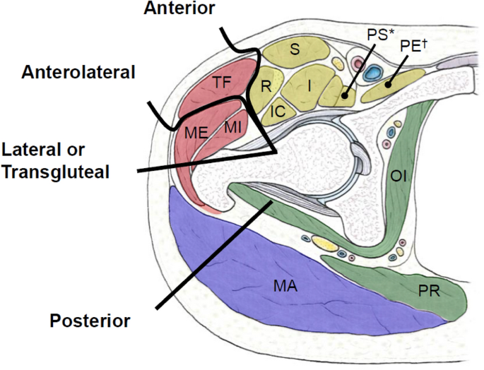 Postoperative muscle atrophy and fatty degeneration with respect to ...