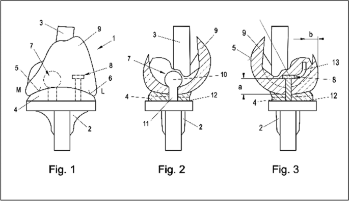 The concept of medial pivot design from primary to revision total knee ...