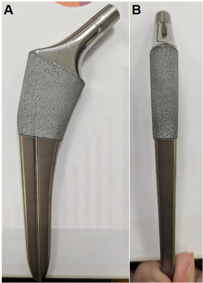 Relationship between stem-bone contact patterns and clinical outcomes ...