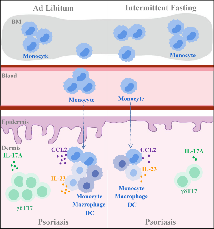 Intermittent fasting alleviates IMQ-induced psoriasis-like dermatitis ...