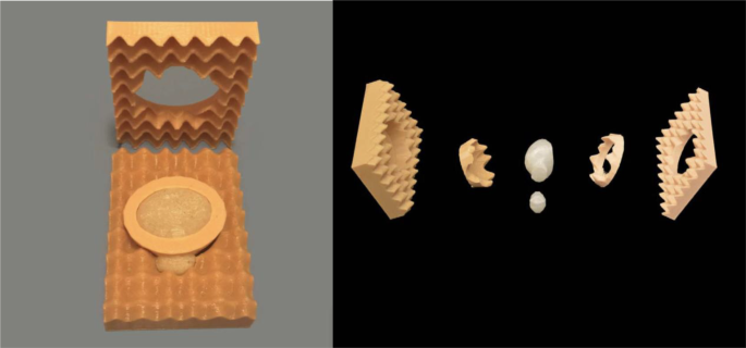 3D models for mohs micrographic surgery: a review on its use in patient ...