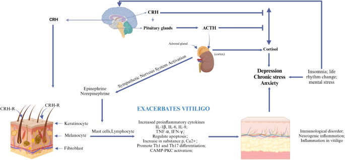 The brain-skin axis in vitiligo | Archives of Dermatological Research