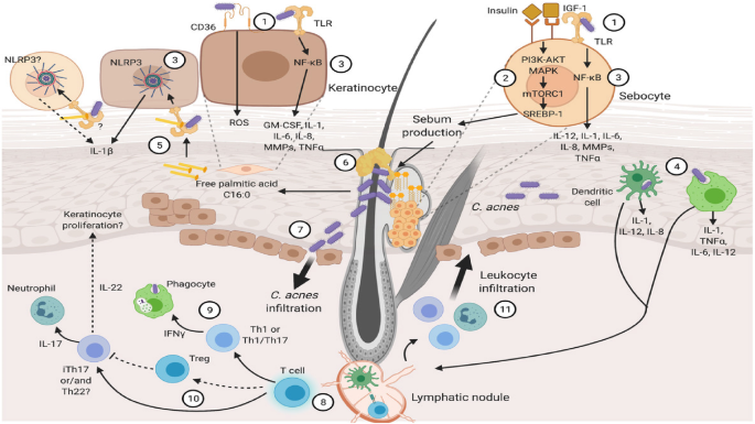 Cutibacterium acnes bacteriophage therapy: exploring a new frontier in ...