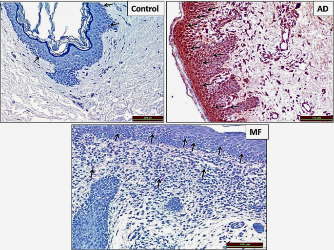 Immunohistochemical investigation of transient receptor potential ...