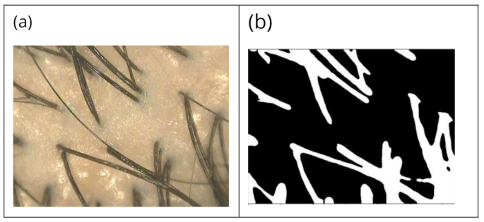 Comparative analysis of automatic hair count estimation methods ...