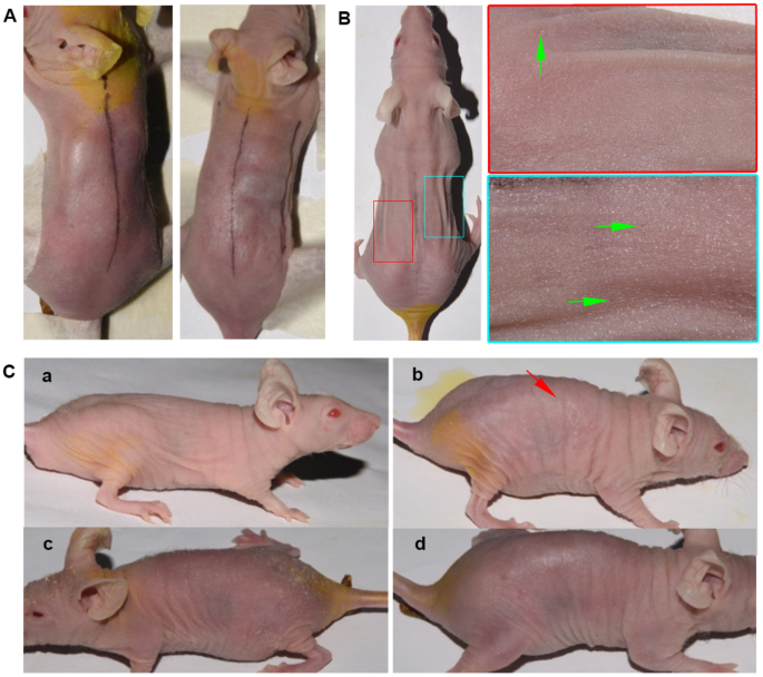 Application of multi-needle injector for delivering human adipose stem ...