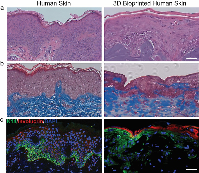 First-in-kind 3D bioprinted human skin model using recombinant human ...