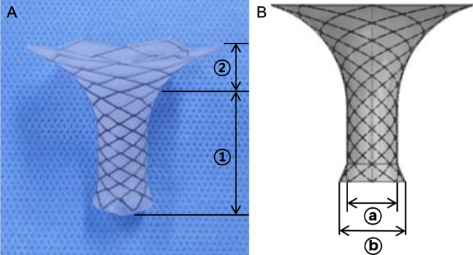 Efficacy and safety of a self-expandable retainer in endoscopic ear ...