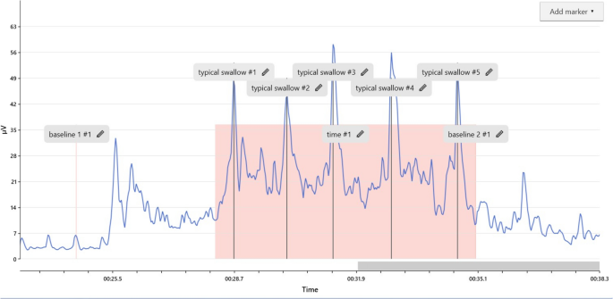 Examining swallowing parameters of the Yale Swallow Protocol in healthy ...