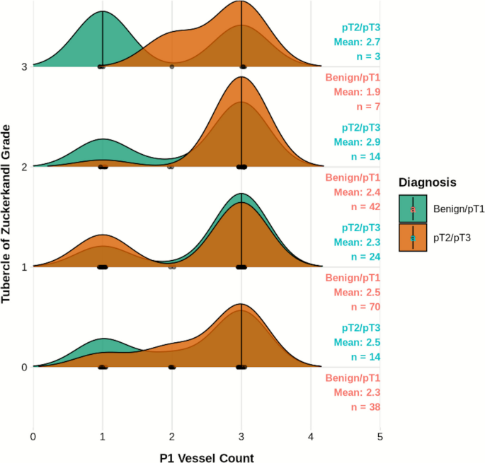 An analysis of vascular pattern in modified P1 zone and relationship ...