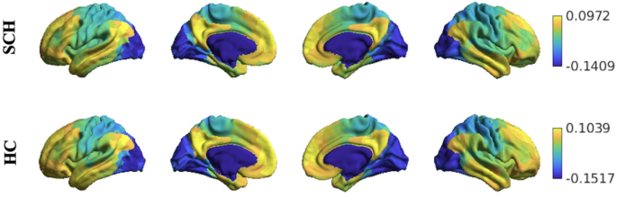 Disrupted cortical organization in schizophrenia based on functional ...