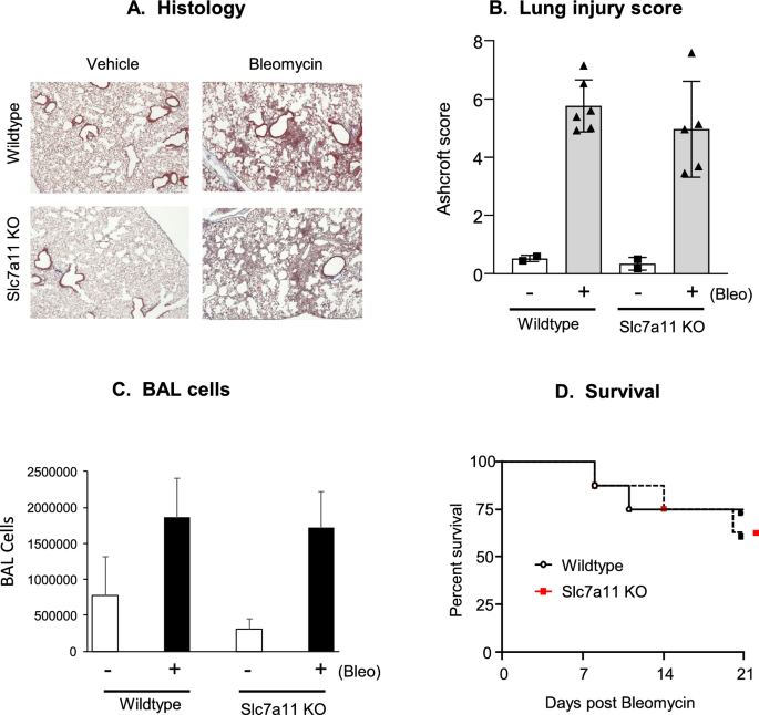 Role of Slc7a11 in Bleomycin-Induced Lung Injury | Lung | Springer ...