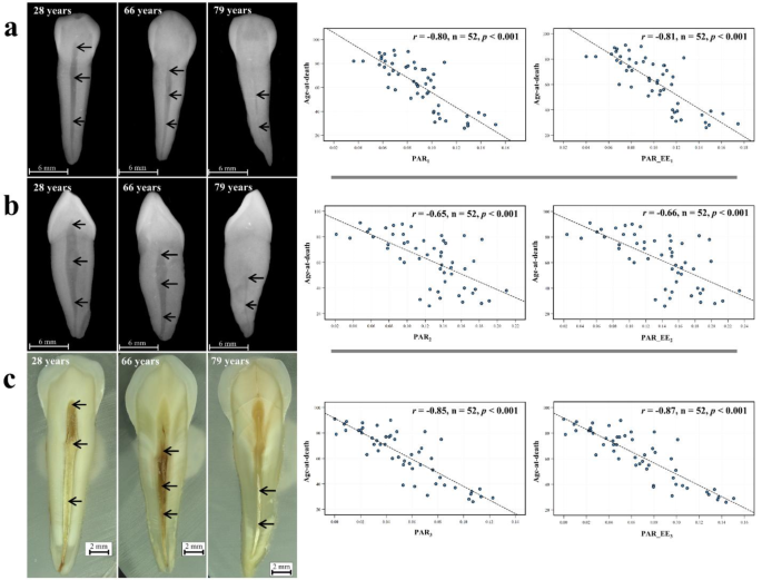Exploring optimal methods for age-at-death estimation using pulp/tooth ...