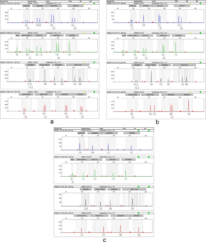 Discovery and comprehensive analysis of a congenital chimerism via ...