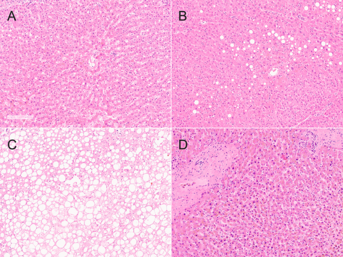 The use of liver biomechanics in forensic pathology | International ...