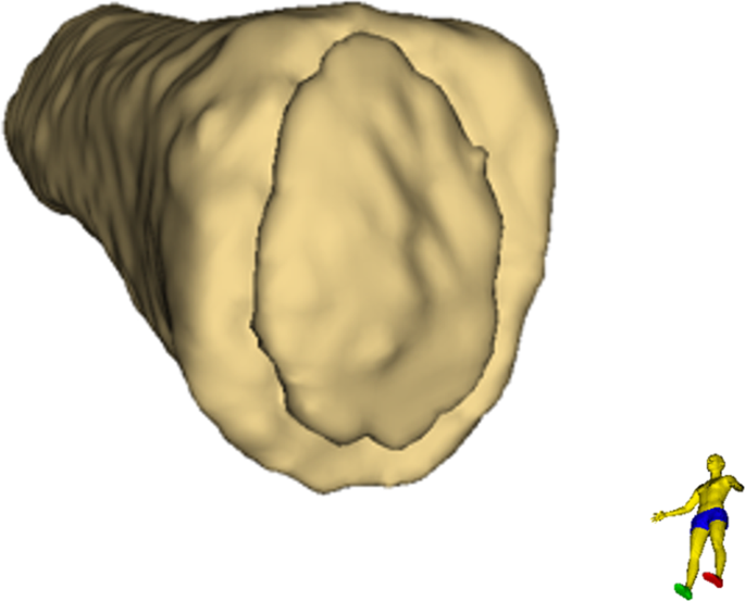Development of an open-source 3D imaging method for forensic age ...
