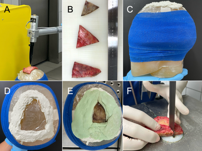 Experimental determination of the stabbing intensity in an intracranial ...