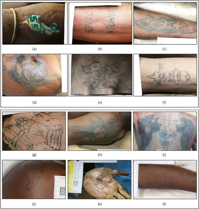 Prevalence and forensic significance of tattoos in unidentified ...