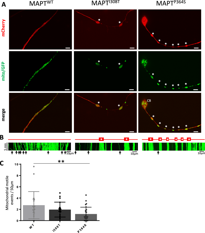 MAPT mutations in amyotrophic lateral sclerosis: clinical ...