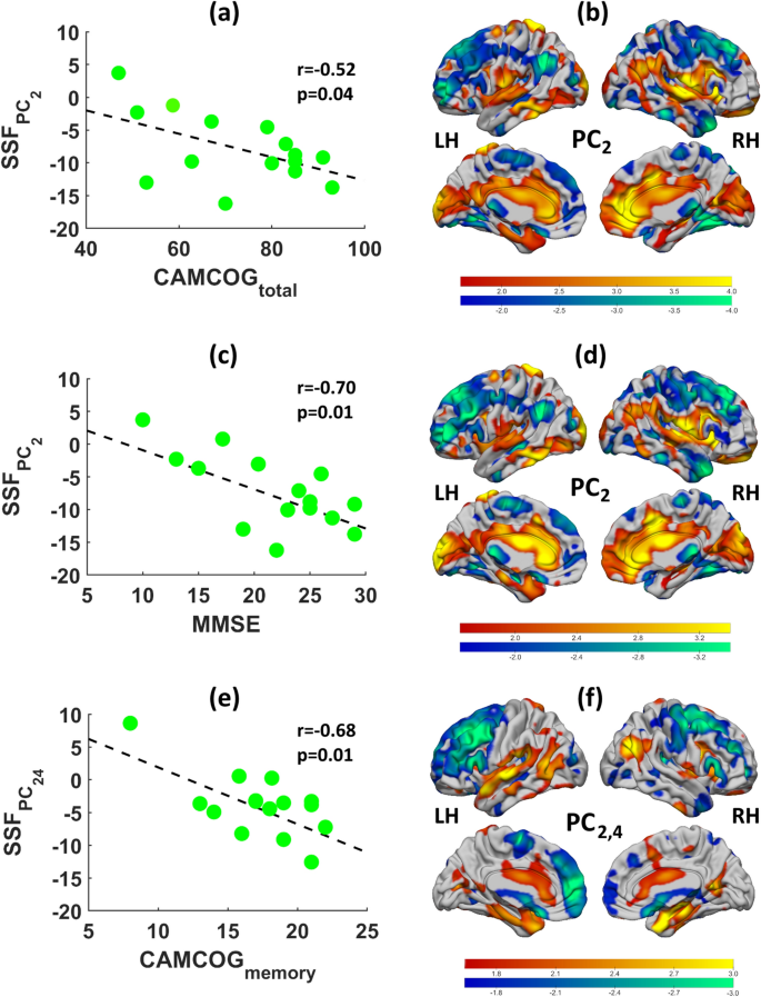 A spatial covariance 123I-5IA-85380 SPECT study of α4β2 nicotinic ...