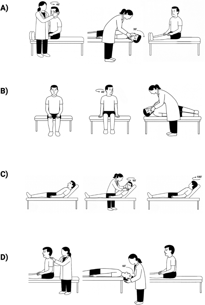 Rethinking positional nystagmus: beyond BPPV | Journal of Neurology