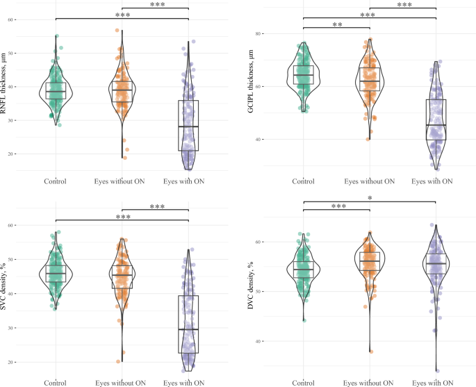 Progressive retinal and microvascular neurodegeneration in ...