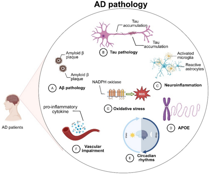 Advances of therapeutic strategies for Alzheimer’s disease | Journal of ...