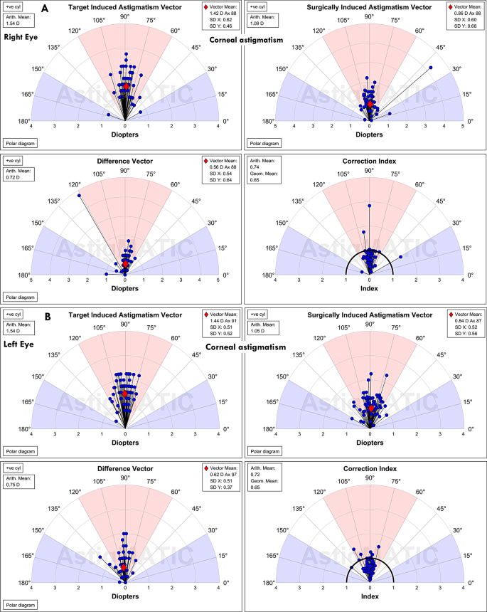 Predicting the impact of femtosecond-assisted arcuate keratotomy ...