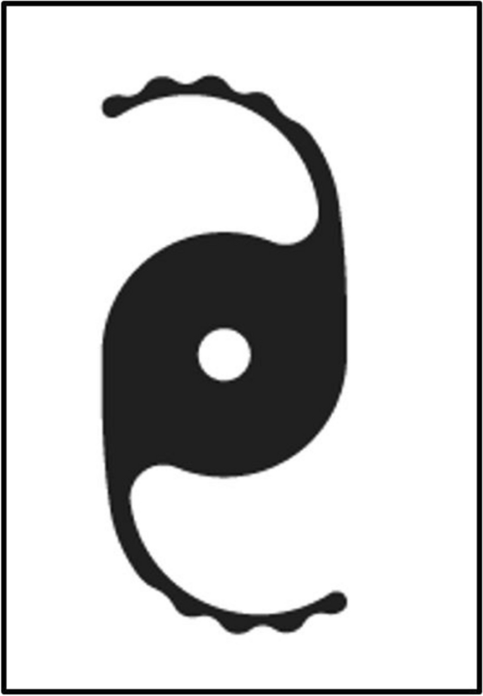 Polypseudophakia: from “Piggyback” to supplementary sulcus-fixated IOLs ...