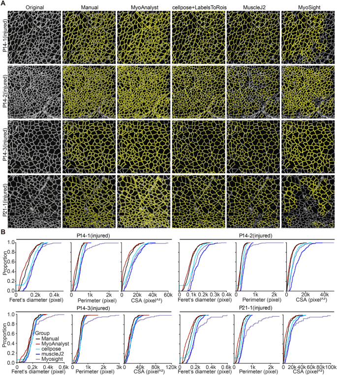 MyoAnalyst: an ImageJ plugin for accurate and automatic myofiber ...