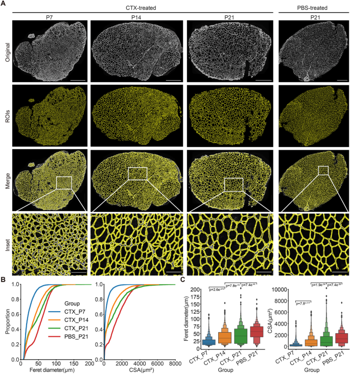 MyoAnalyst: an ImageJ plugin for accurate and automatic myofiber ...