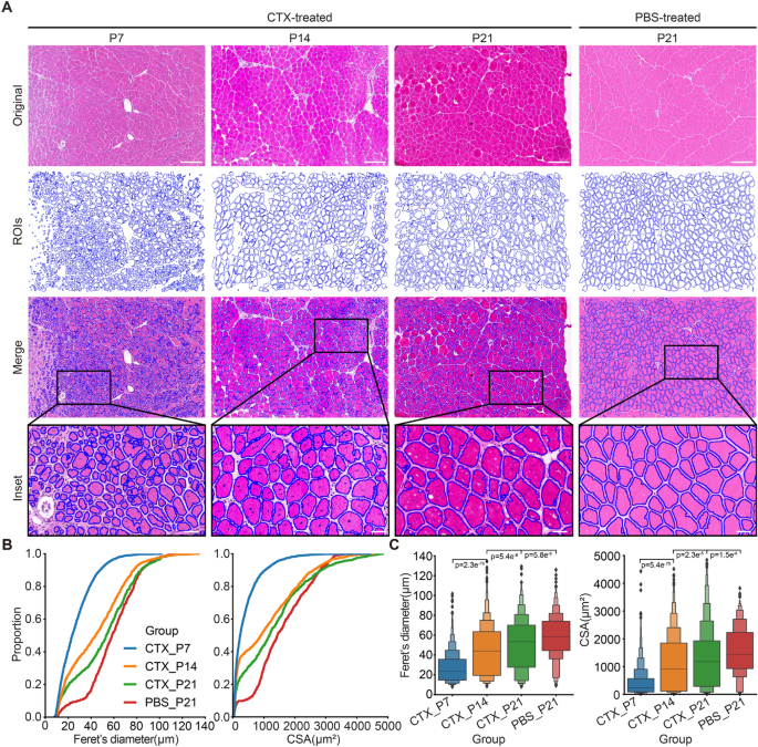 MyoAnalyst: an ImageJ plugin for accurate and automatic myofiber ...